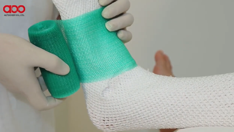 Altocast Polyester Casting Tape